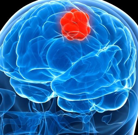 NightHawk Radiology: 24/7 Teleradiology & Telemedicine